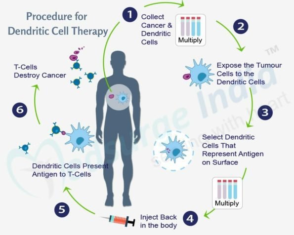 Who Is The Right Candidate For Dendritic Cell Therapy | Medsurge India