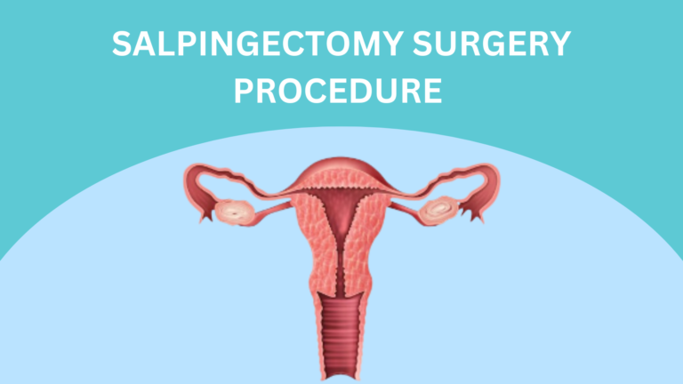 Salpingectomy Surgery Cost In India | Types & Procedure | Medsurge India