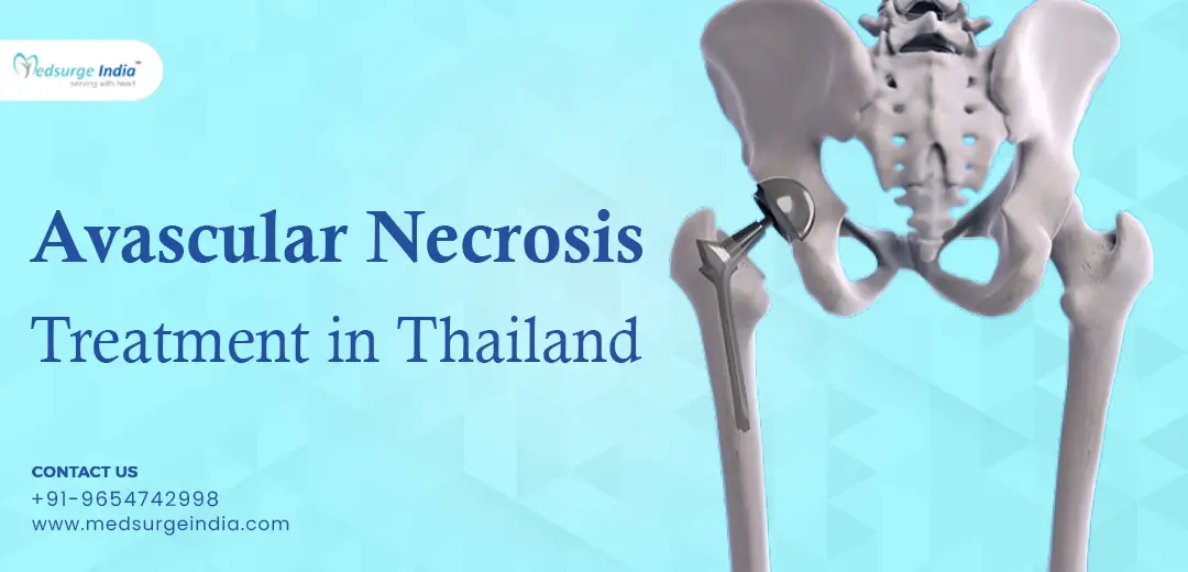 Avascular Necrosis Treatment Cost In Thailand | Medsurge India
