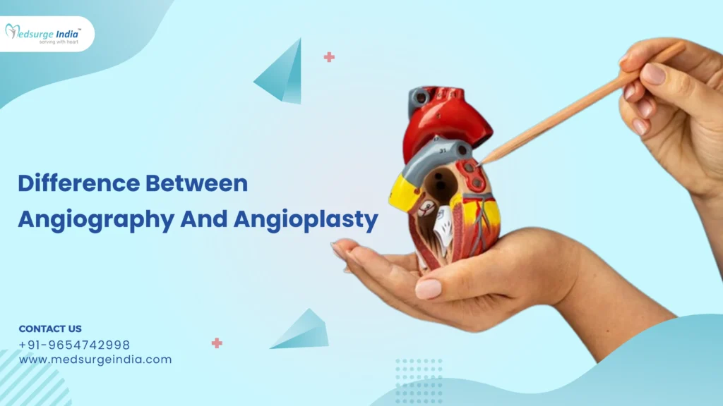 Difference Between Angiography And Angioplasty | Medsurge India Difference Between Angiography And Angioplasty | Medsurge India