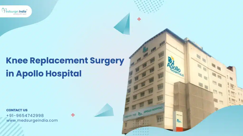 アポロ病院における膝関節置換手術の費用 | 整形外科治療